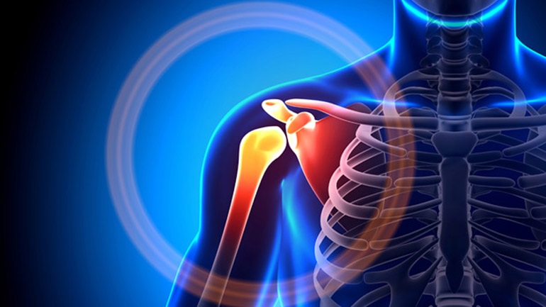 ¿A qué se debe el dolor de huesos? - Gadgets Magazine